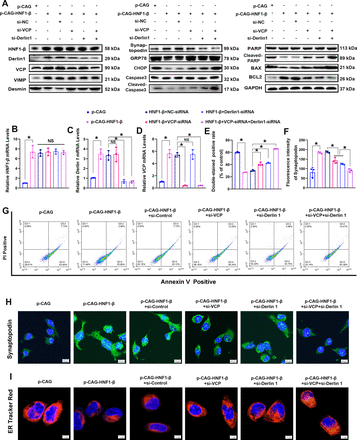 HNF-1β alleviates podocyte injury in lupus nephritis by maintaining ...