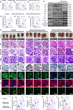 HNF-1β alleviates podocyte injury in lupus nephritis by maintaining ...