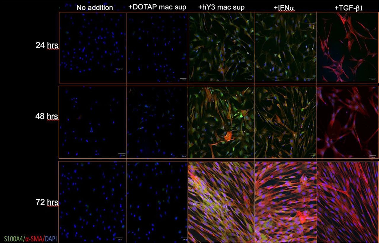 1302 Fetal cardiac and neonatal dermal fibroblast phenotypes and ...