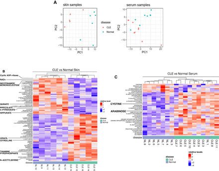 Metabolic profiles of cutaneous lupus have abnormalities in the ...
