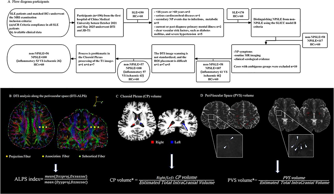Alterations in the DTI-ALPS index and choroid plexus volume as brain ...